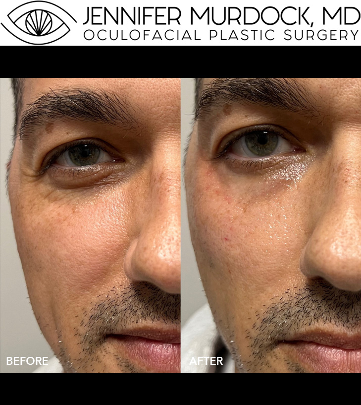 Before and After Photo Gallery | Jennifer Murdock MD
