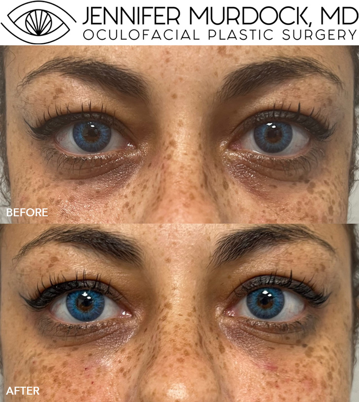 Before and After Photo Gallery | Jennifer Murdock MD